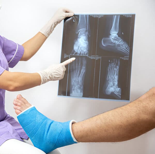 Using Shimmer sensing technology to assess ankle evertors’ insufficiency