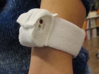 Tele-Epilepsy and Remote Seizure Monitoring using Shimmer Sensors